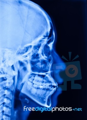 X-ray Stock Photo - Royalty Free Image ID 100133105